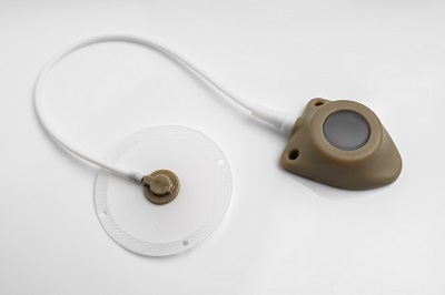 ASDIA partenaire de l'étude clinique pilote ExOlin®